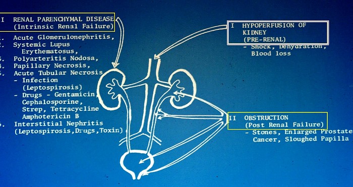 Acute Kidney disease and acute kidney injury.
